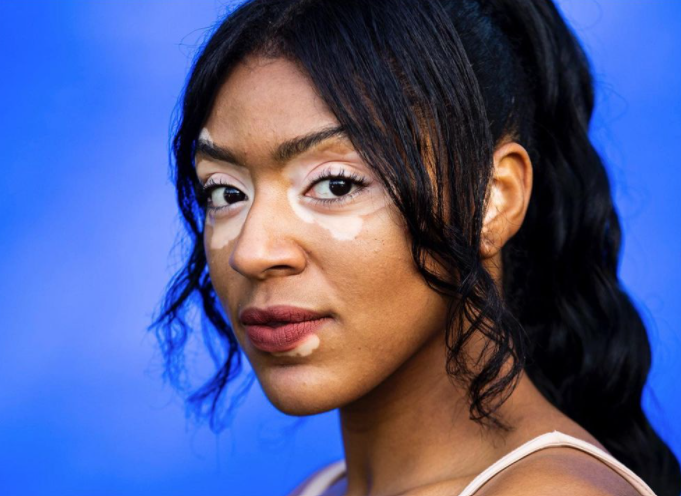 Embracing Your Perfect Imperfections - BALANCE